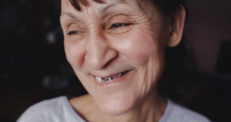 How Do Front Teeth Develop Cavities? | Dentist Leesburg | Dr. Eddie C ...